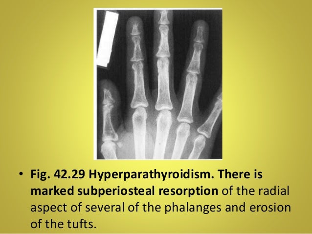 42 DAVID SUTTON PICTURES METABOLIC AND ENDOCRINE DISORDERS AFFECTING