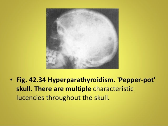 42 DAVID SUTTON PICTURES METABOLIC AND ENDOCRINE DISORDERS AFFECTING