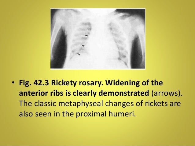 42 DAVID SUTTON PICTURES METABOLIC AND ENDOCRINE DISORDERS AFFECTING