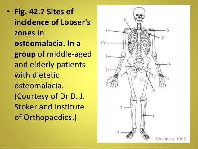 42 DAVID SUTTON PICTURES METABOLIC AND ENDOCRINE DISORDERS AFFECTING