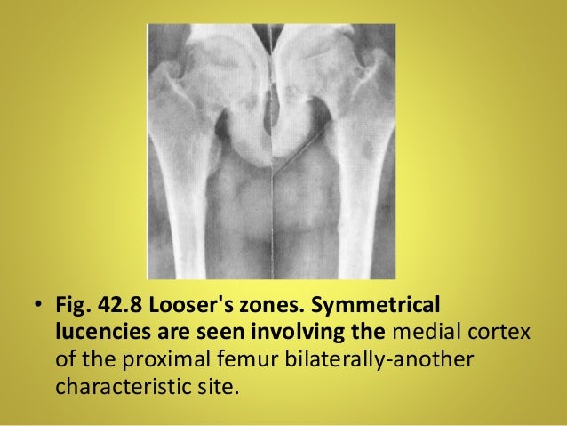 42 DAVID SUTTON PICTURES METABOLIC AND ENDOCRINE DISORDERS AFFECTING