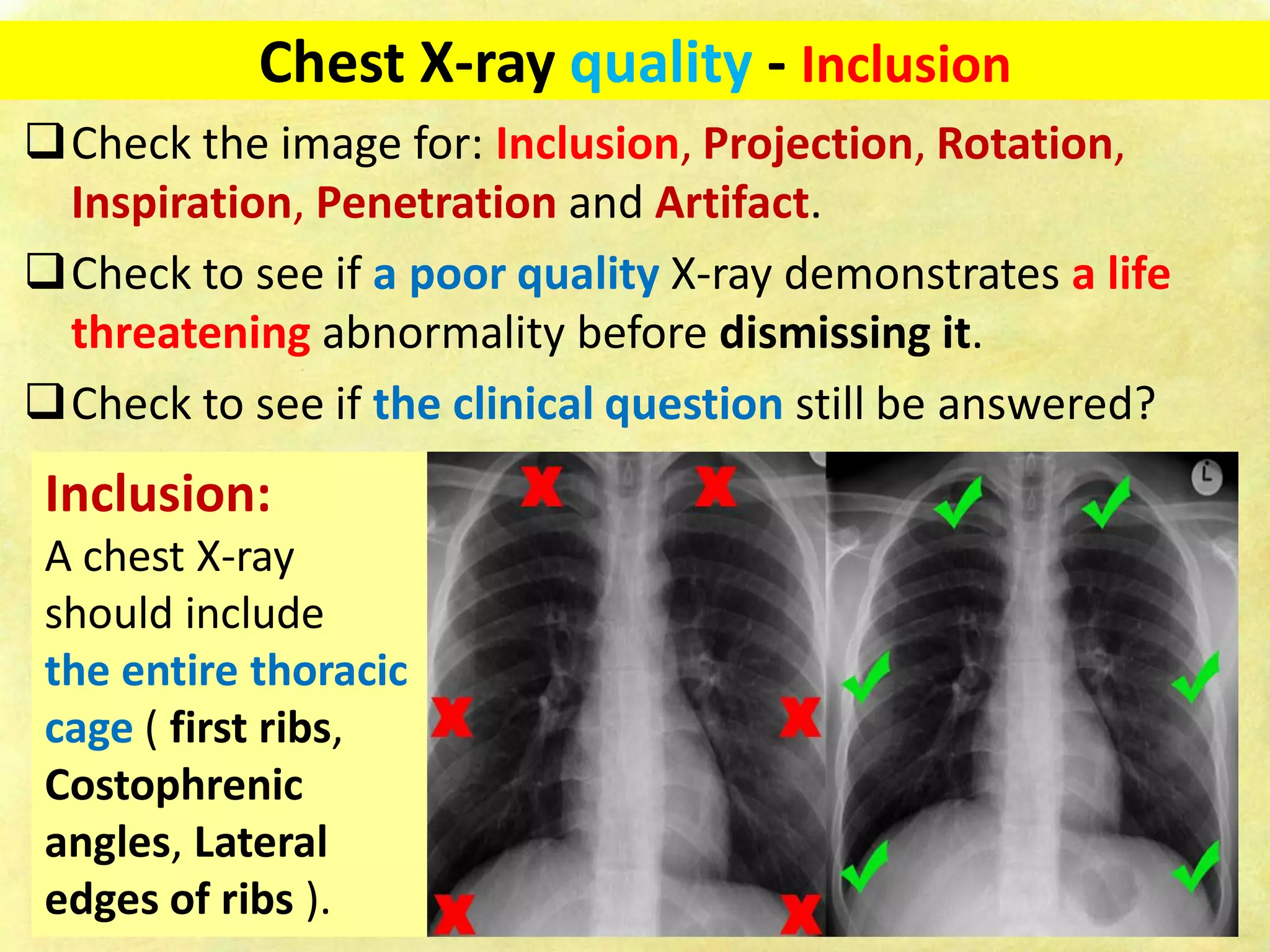 Chest x ray-fundamentals | PDF