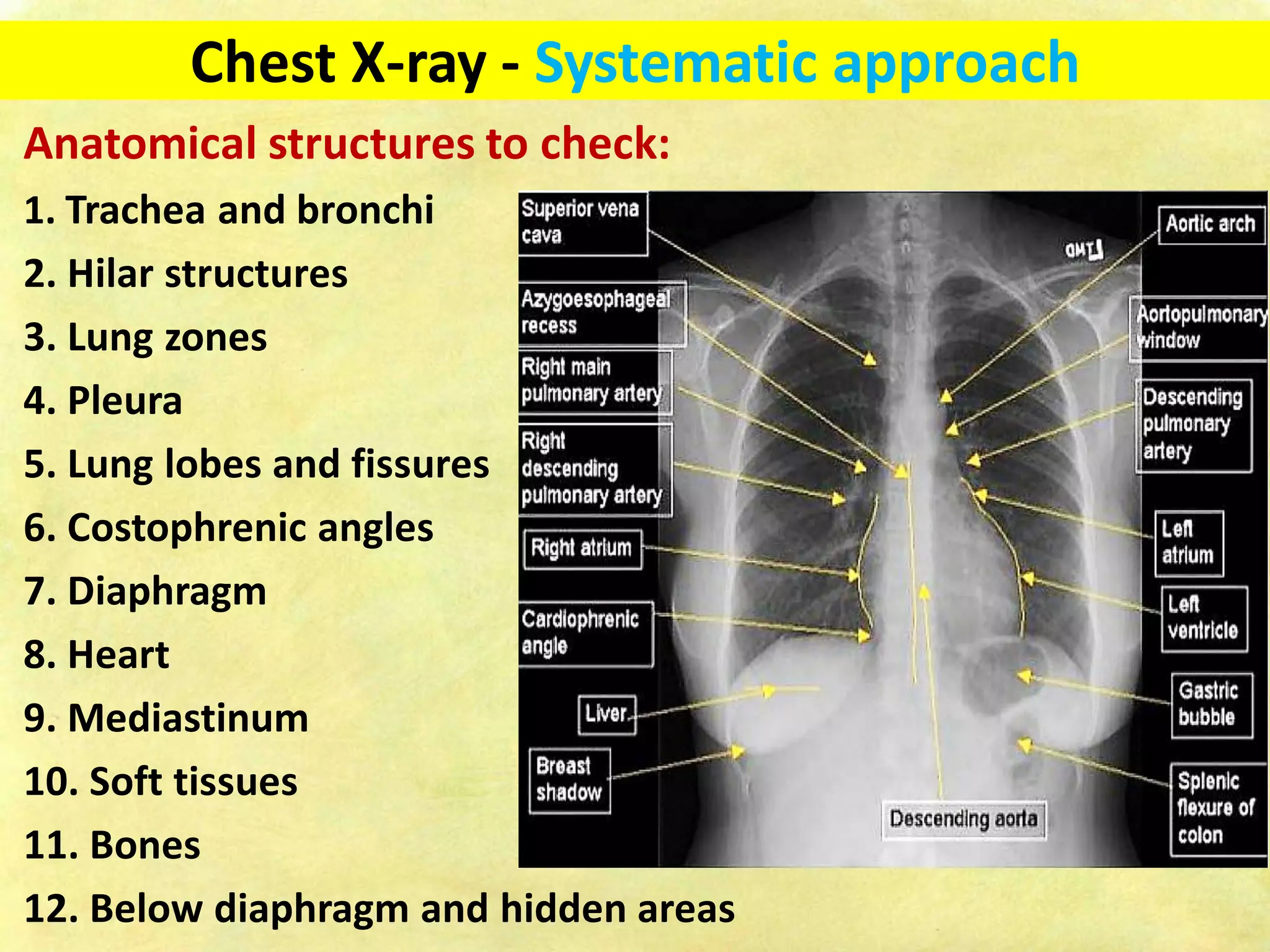 Chest x ray-fundamentals | PDF