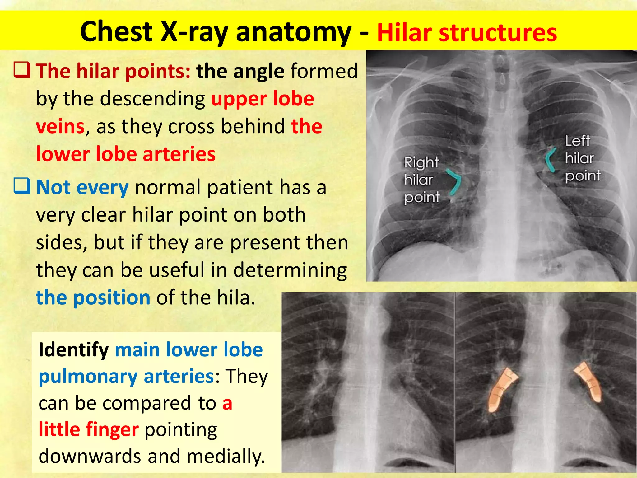Chest x ray-fundamentals | PDF