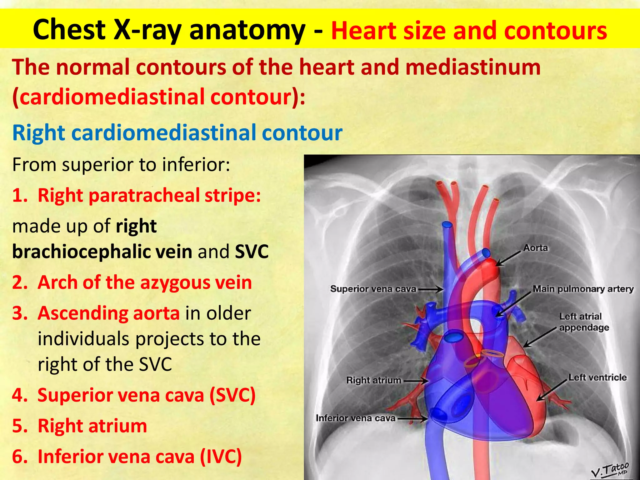 Chest x ray-fundamentals | PDF