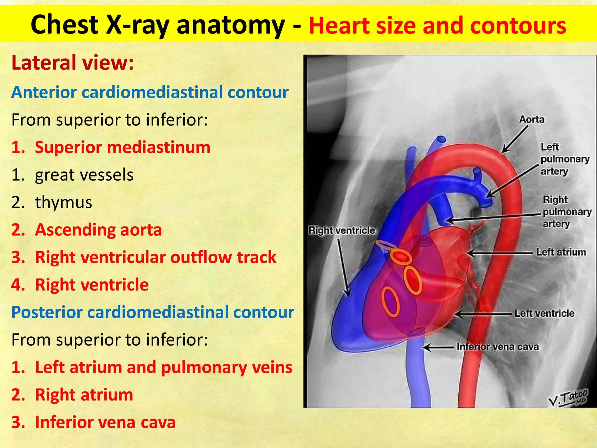 Chest x ray-fundamentals | PDF