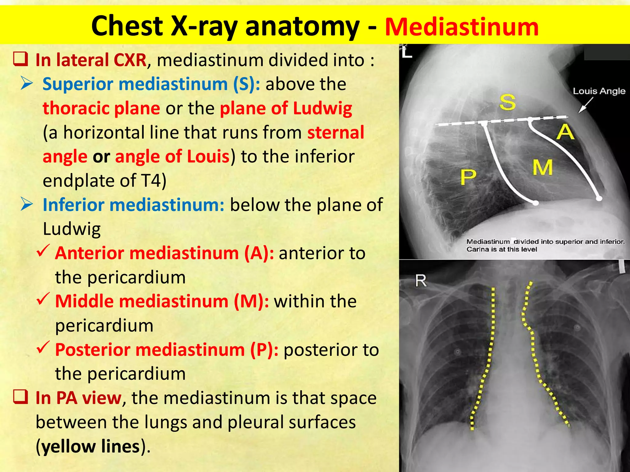 Chest x ray-fundamentals | PDF
