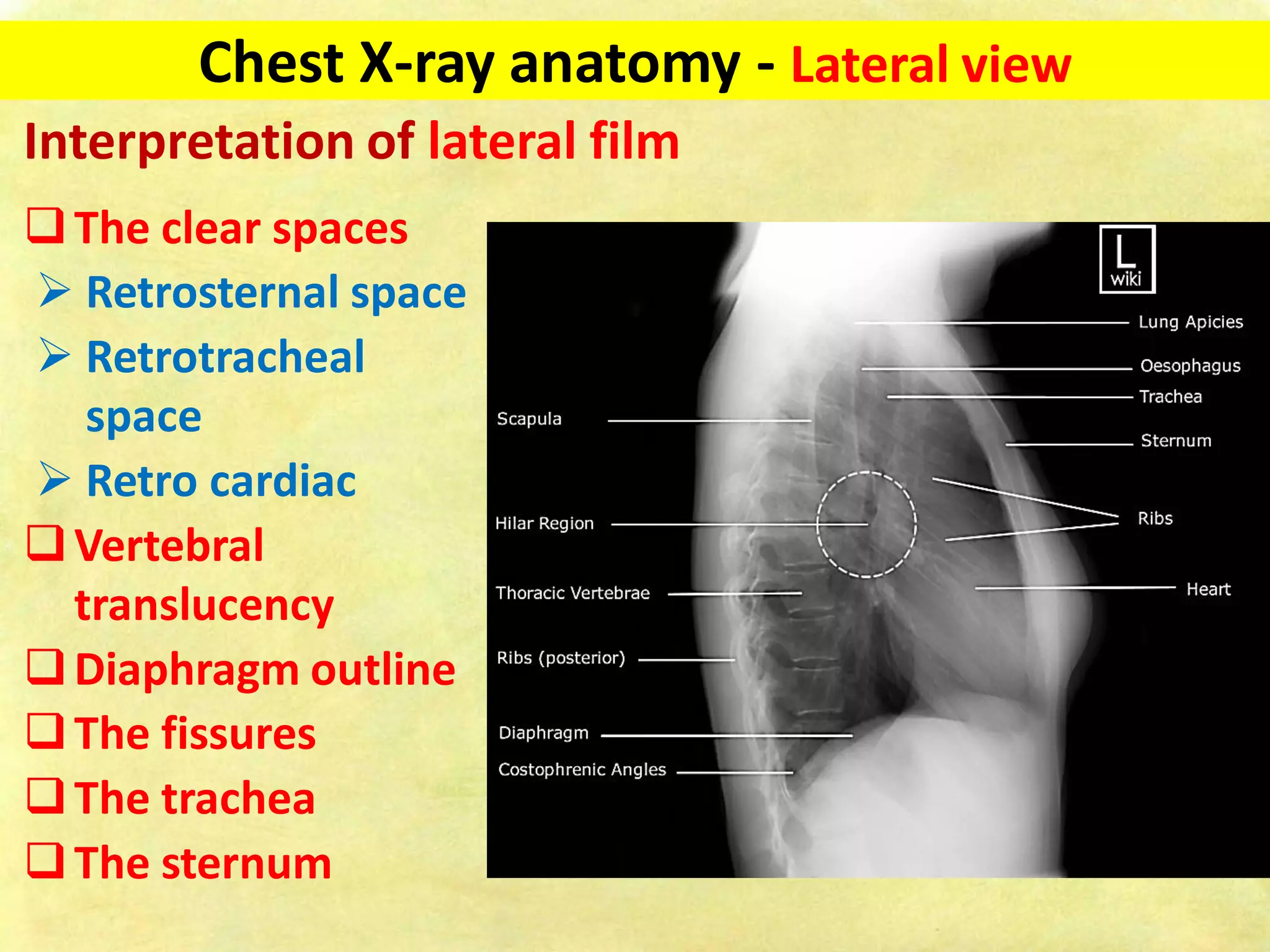 Chest x ray-fundamentals | PDF