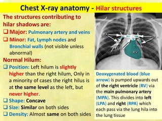 Chest x ray-fundamentals | PDF