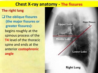Chest x ray-fundamentals | PDF
