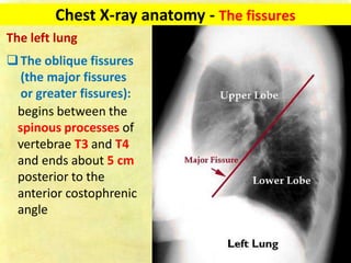 Chest x ray-fundamentals | PDF