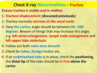 Chest x ray-fundamentals | PDF