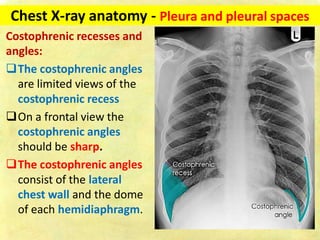 Chest x ray-fundamentals | PPT