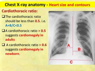 Chest x ray-fundamentals | PPT