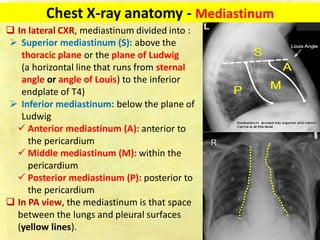 Sternal Angle X Ray