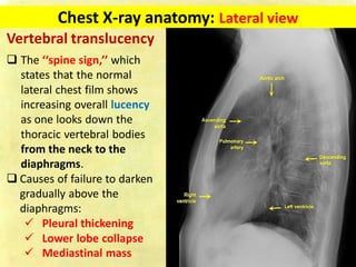 Normal Lateral Chest X Ray