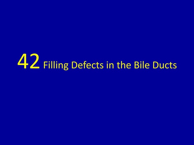 42 filling defects in the bile ducts | PPT