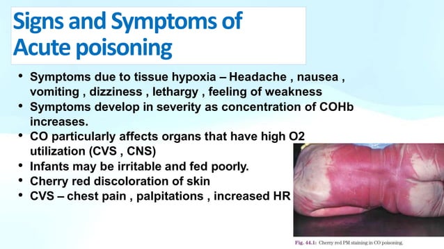 Co poisoning forensic medicine mbbs 3rd year | PPT
