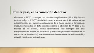 Pie equinovaro | PPTX