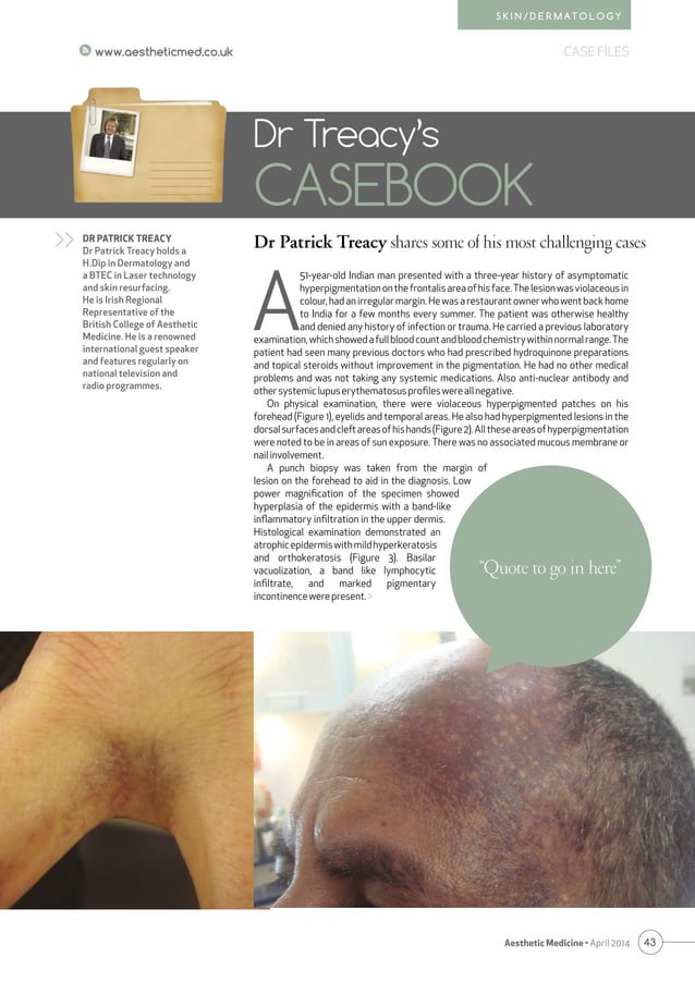 Dr. Treacy's Dermatology Casebook No 1 | PDF