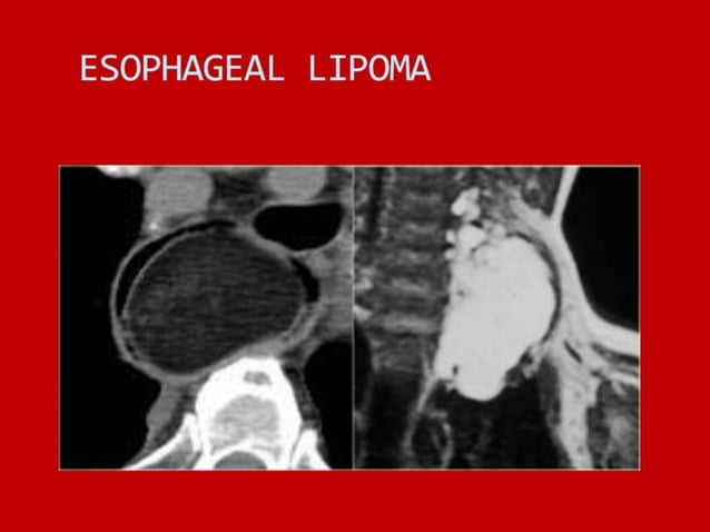 43 Dr Ahmed Esawy imaging oral board of bowel imaging part I ...