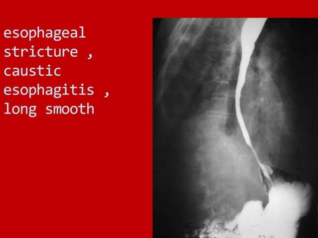 43 Dr Ahmed Esawy imaging oral board of bowel imaging part I ...