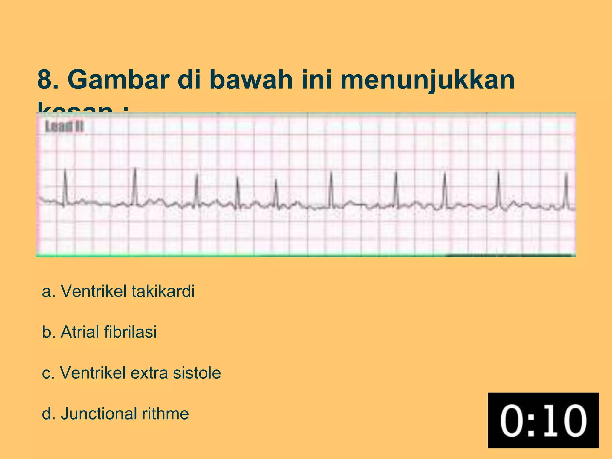 430708458 soal post test ekg | PPT