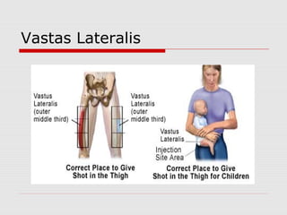 Vastus Lateralis Injection Site
