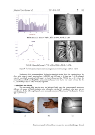 Smartphone aided real-time blood vein detection system | PDF