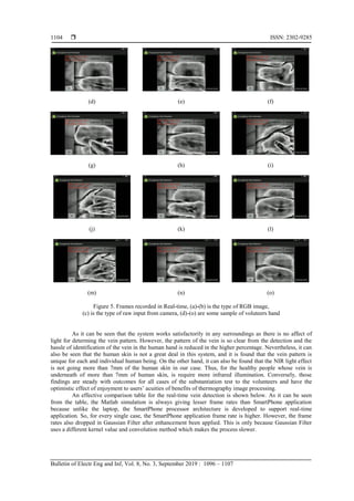Smartphone aided real-time blood vein detection system | PDF | Blood Disorders | Diseases and ...