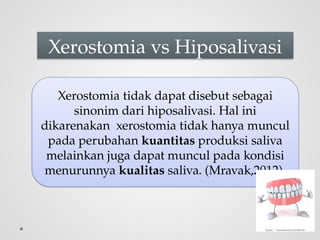 431823179-Xerostomia-Dan-Hiposalivasi-PPT-Fixed.pptx