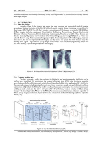 Attention mechanism-based model for cardiomegaly recognition in chest X-Ray images | PDF