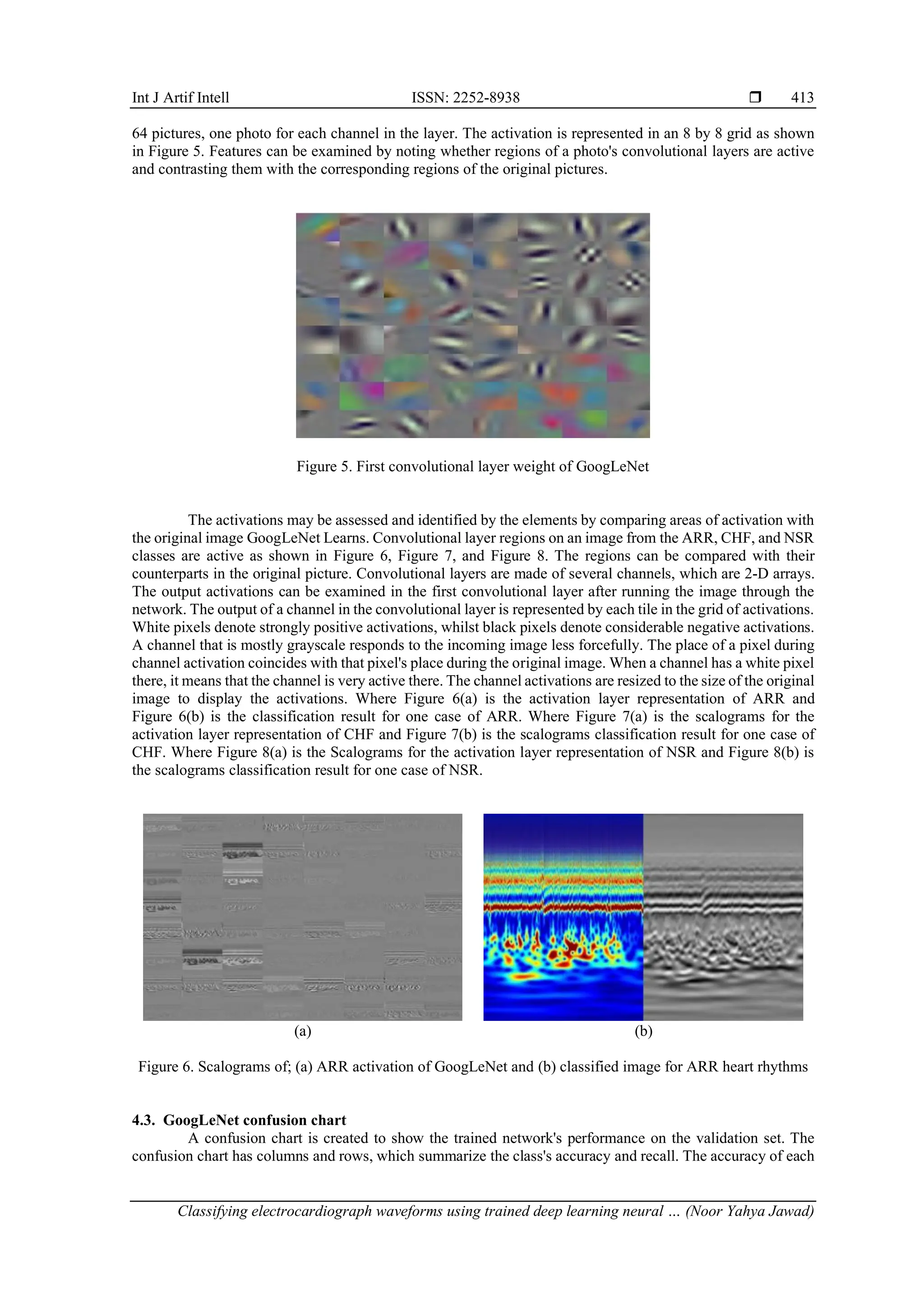 Classifying electrocardiograph waveforms using trained deep learning neural network based on ...