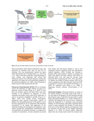 Potential of Anisakiasis in Foodborne Zoonosis | PDF