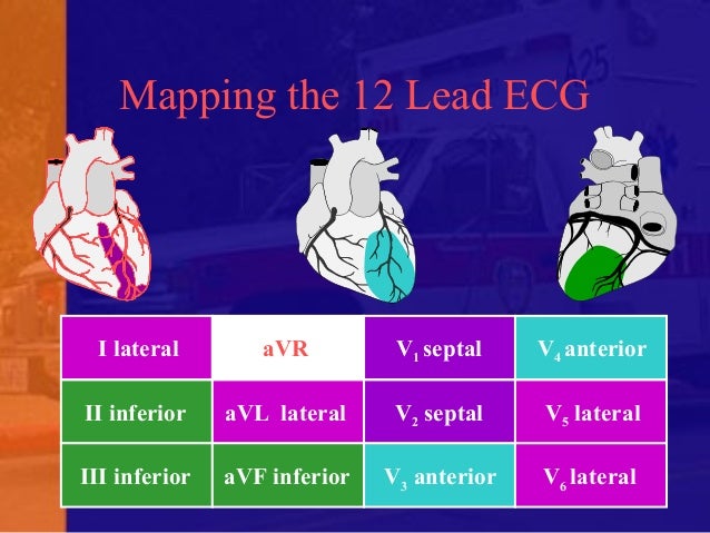 2 Minute 12 Leads V5