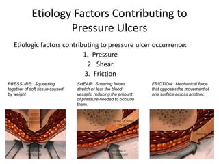 Image Of Friction And Shear Pressure