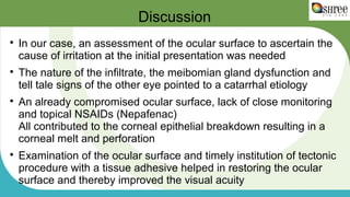 Corneal Perforation After Topical Nepafenac Eyedrops In A Case Of ...