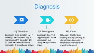 ppt miastenia gravis MG ppt miastenia gravis MG | PPTX