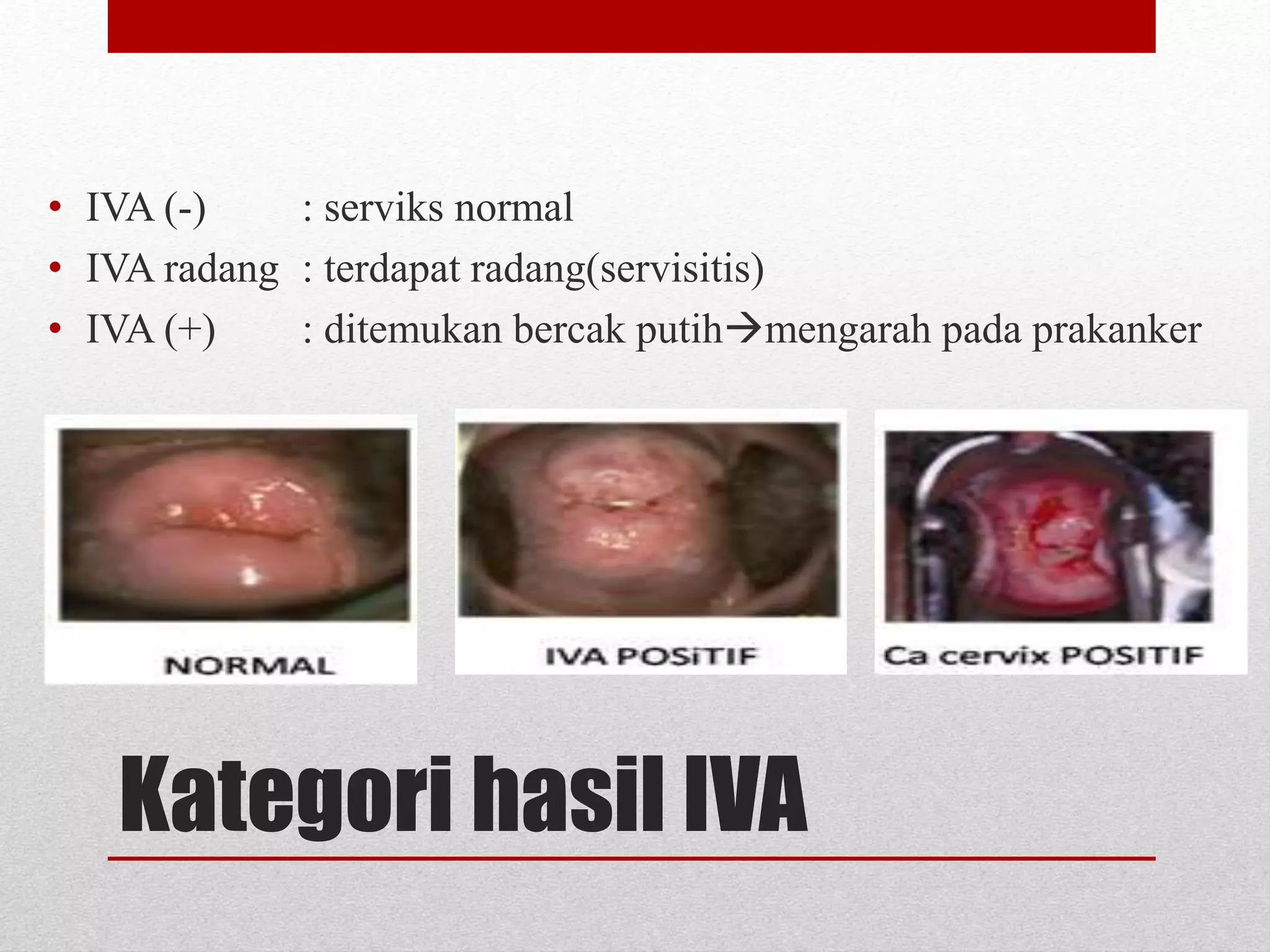 437991018-Power-Point-Iva-Lengkap.pptx