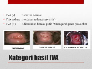 437991018-Power-Point-Iva-Lengkap.pptx