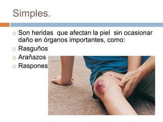 43 generalidades de heridas | PPTX