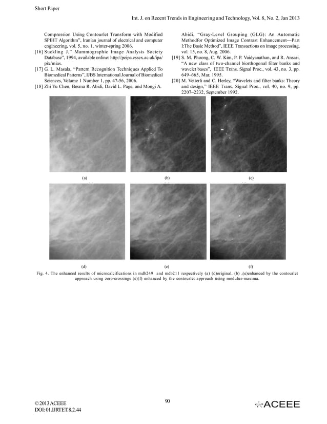 Mammographic Feature Enhancement using Singularities of Contourlet Transform | PDF