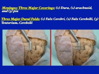 44 cer vascul (1) | PPT