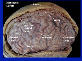 44 cer vascul (1) | PPT