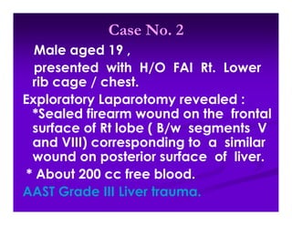 Liver trauma conference presentation | PPT
