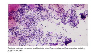 44 lower genital tract infection 10-5-2019 | PPTX