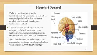 440097912-ppt-herniasi.pptx