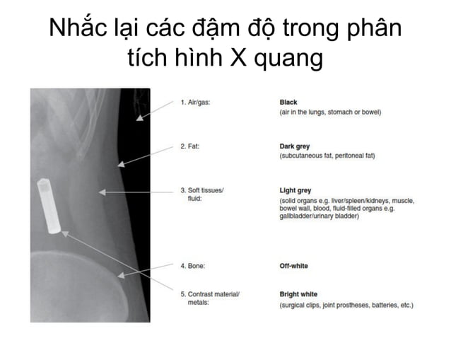 Xquang bụng không sửa soạn ts bs võ tấn đức | PDF