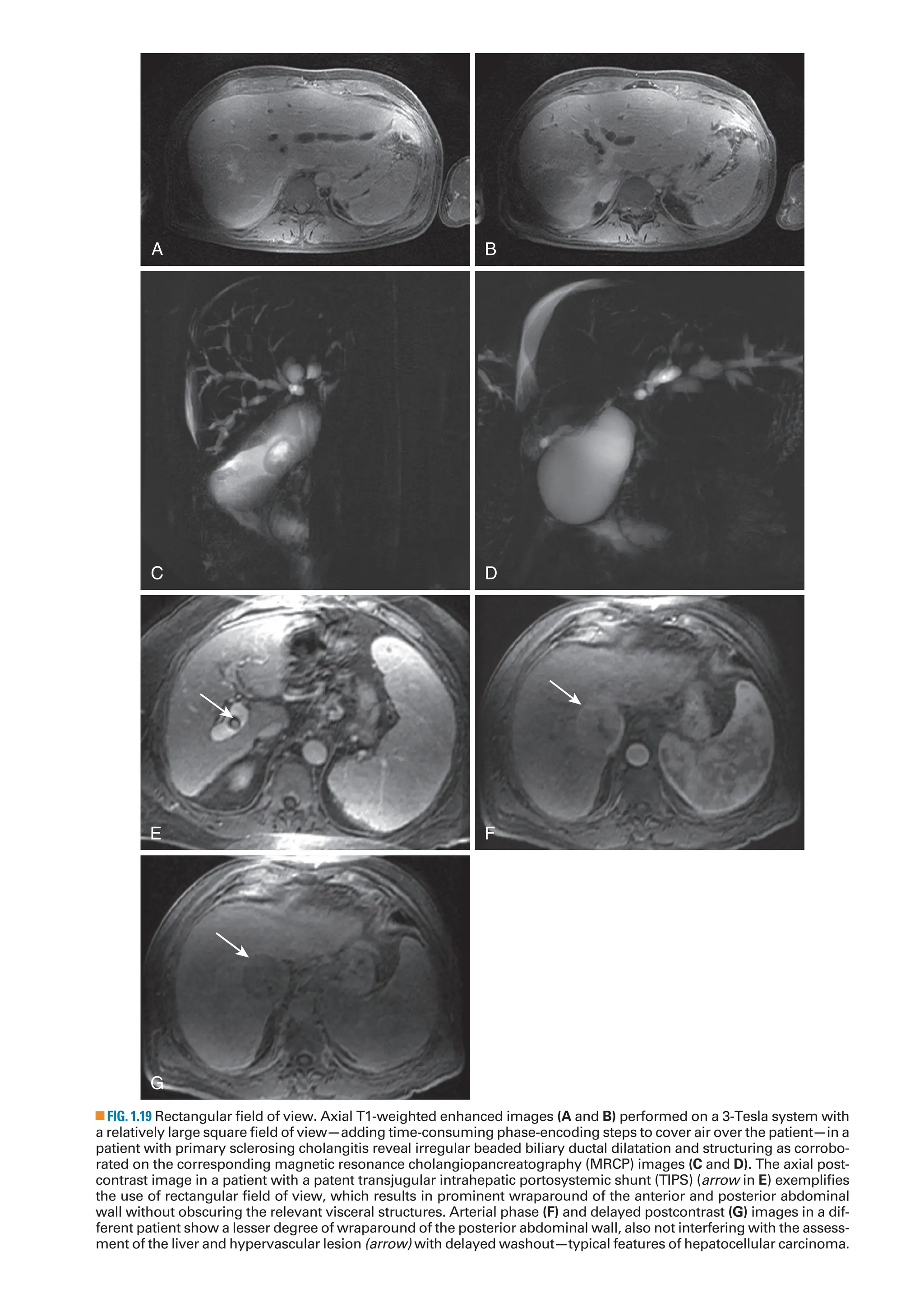 Fundamentals of Body MRI Christopher Roth | PDF