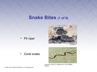 Animal Bites WITH ITS IMPLICATIONS4438619.ppt